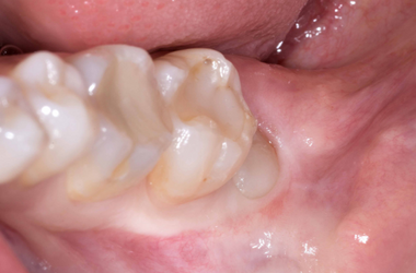 ethoss case studies - Swallow Dental