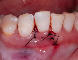 ethoss case studies - Swallow Dental