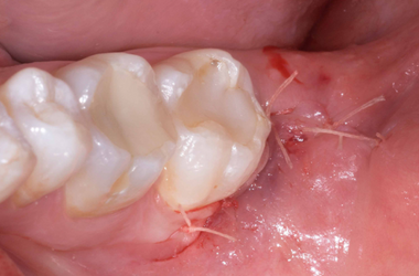 ethoss case studies - Swallow Dental