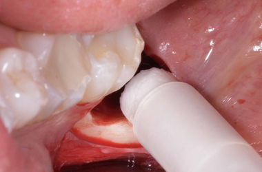 ethoss case studies - Swallow Dental