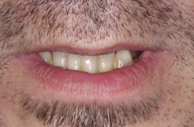 ethoss case studies - Swallow Dental